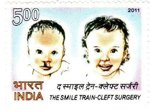 India The Smile Train - Cleft Palate Surgery Postage Stamp ...